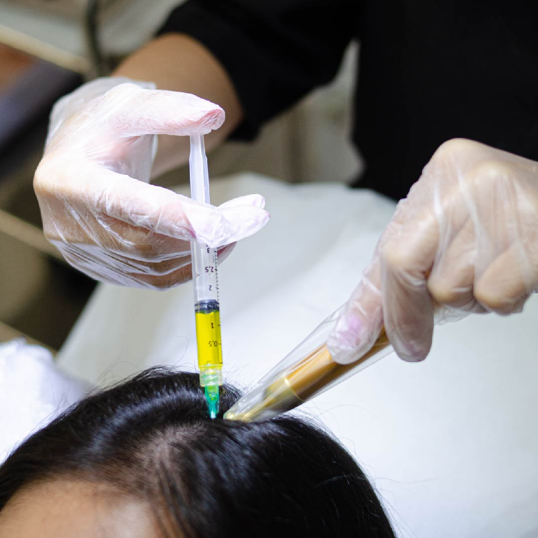 Dermatre Capilar – tratamento dermatológico da queda de cabelo e ...