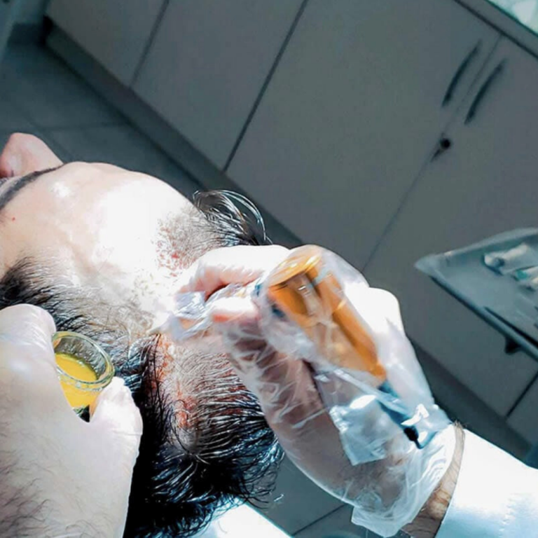 Dermatre Capilar – tratamento dermatológico da queda de cabelo e ...